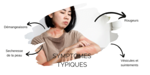 Eczéma Bras : les conseils d'un patient atteint de dermatite atopique